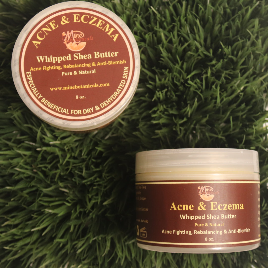 Acne & Eczema Whipped Shea Butter – Nature’s Galore